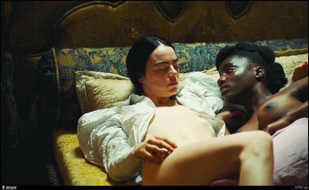 Skincoming On Dvd And Blu Ray Poor Things Anyone But You And More 3 8553