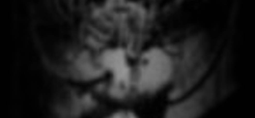Hottest Fat Faded Fuck Face Nudity Watch Clips And See Pics Mr Skin